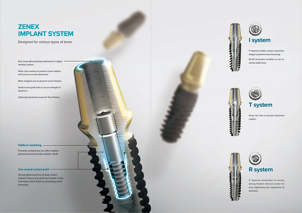 ZENEX MULTI&PLUS Implant System