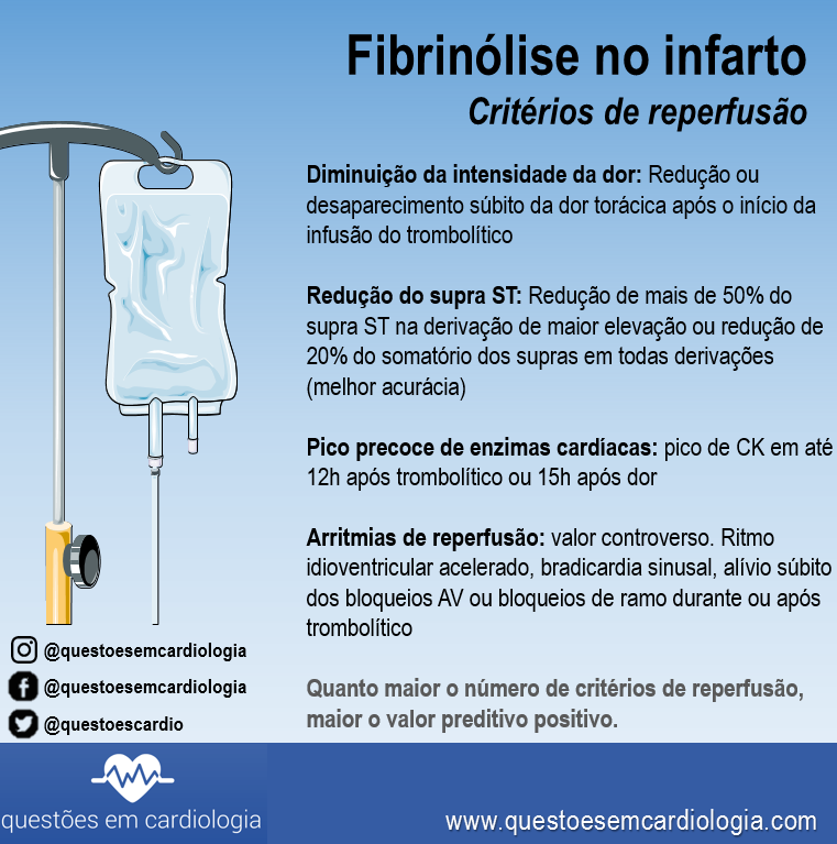 Fibrinólise no infarto: critérios de reperfusão