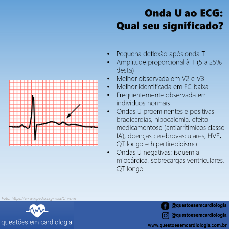 Onda U ao ECG: qual o significado?