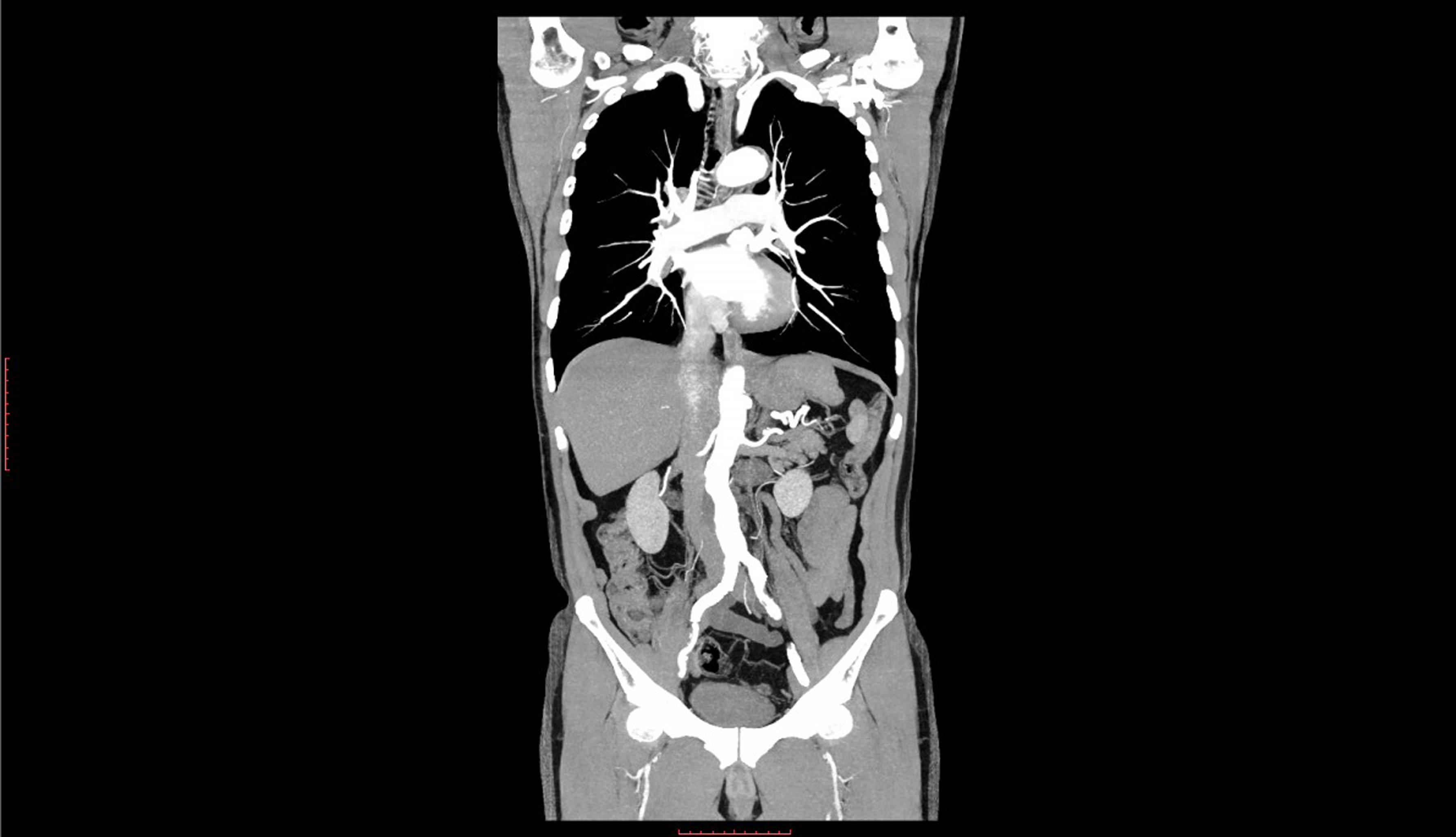 Other Vascular Conditions | My Site