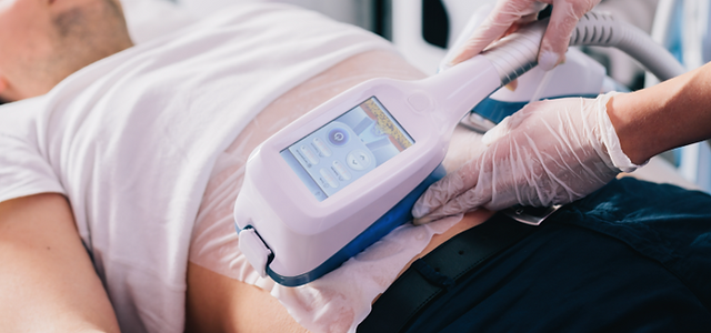 fat freezing procedure