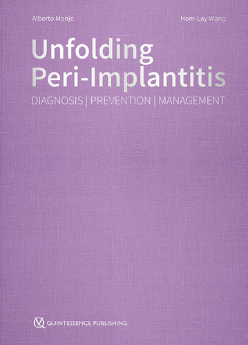 Unfolding Peri-Implantitis Diagnosis | Prevention | Management ...