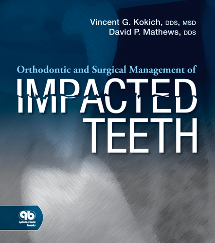 Orthodontic and Surgical Management of Impacted Teeth | Hartman Books