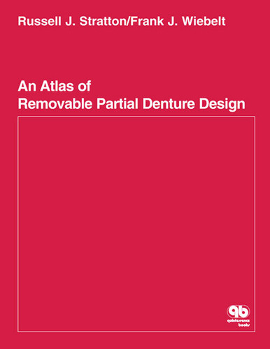 An Atlas of Removable Partial Denture Design | Hartman Books
