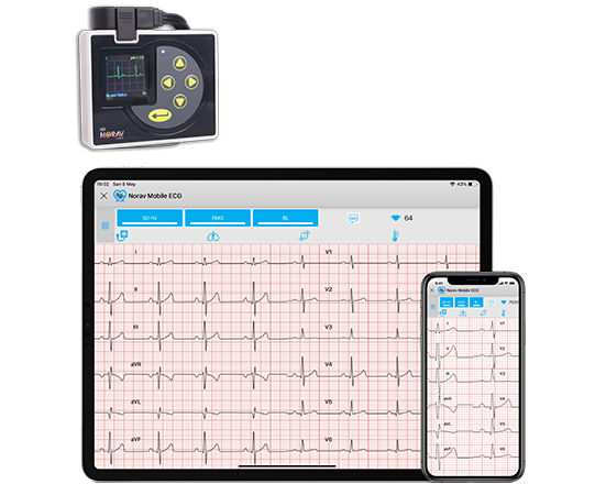 ECG Mobile App | Record & Send 12 Lead ECGs on Phone/Tablet | Norav