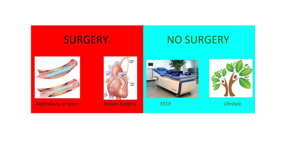 Surgery or No Surgery for Heart Disease