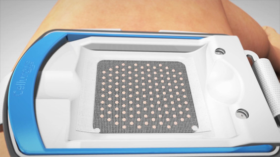 CelluTome | mmsurgical