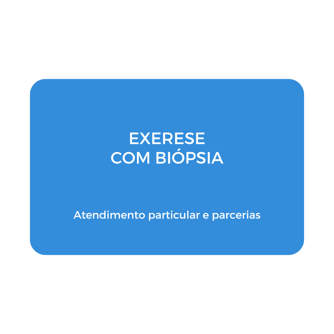 Exerese com biópsia | Clínica BHmed | Avenida Augusto de Lima
