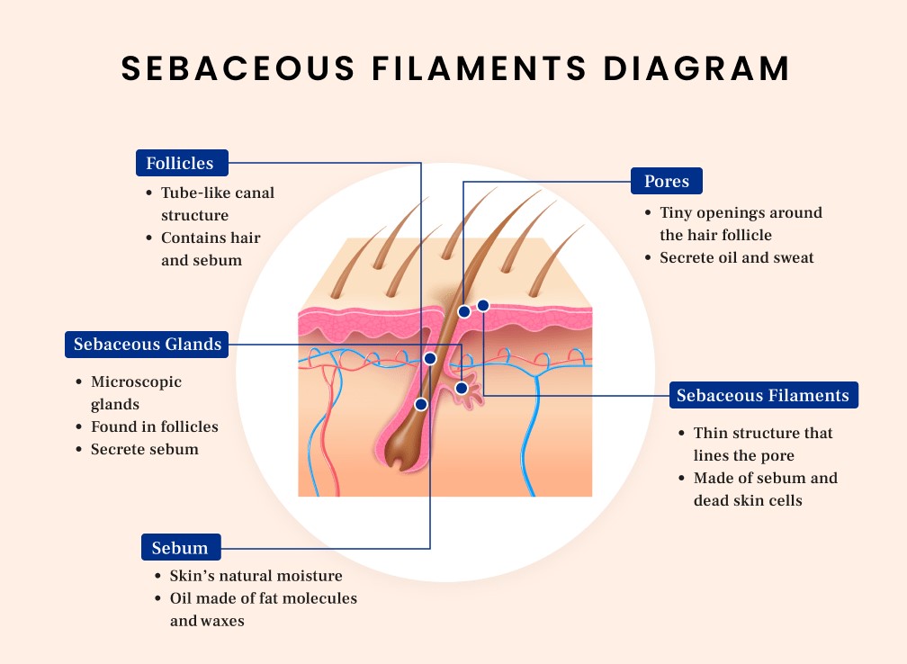 Sebaceous Filaments: They're Not What You Think