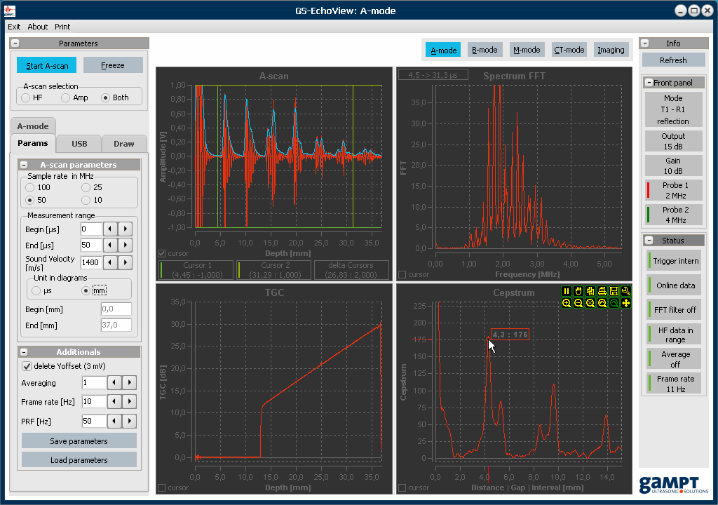 Échoscope à ultrasons GS200i | Nova Physics