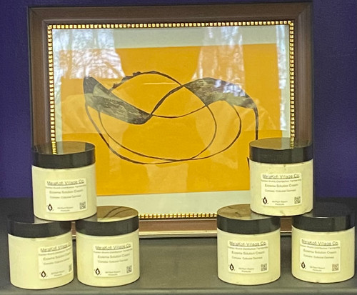 Eczema Cream | Sacred Womb