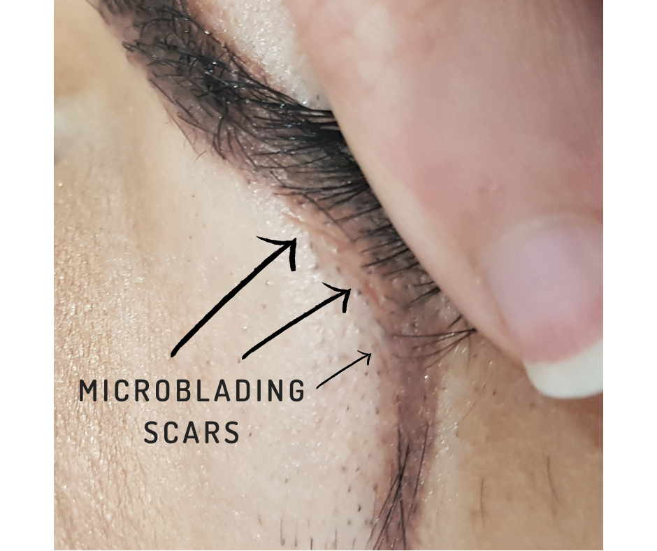 5 Reasons Why You DON'T Want Microblading