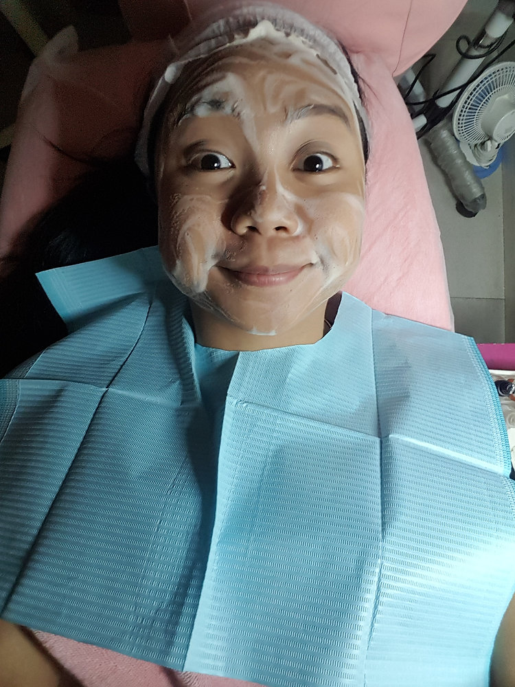 Fractional Needling Therapy (FNT) with Biotulin at Flawless