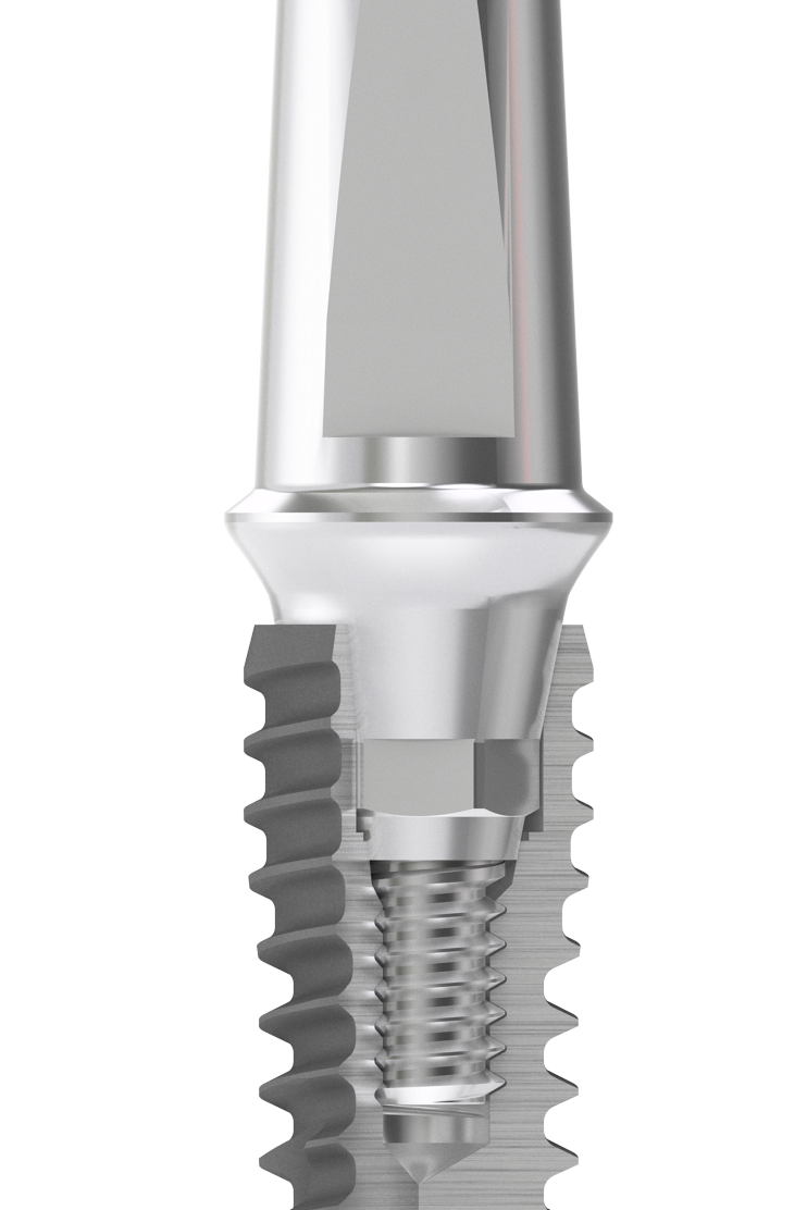 S Fixture | DENTAL MATE