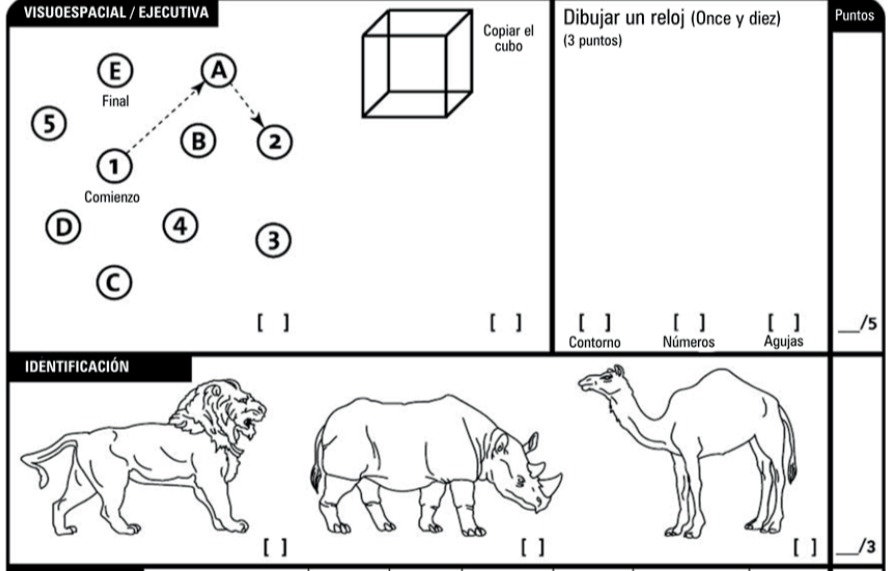 MoCA test. Montreal Cognitive Assessment