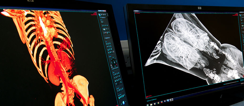 News | Digital Autopsy | The Future of Post Mortem Examinations