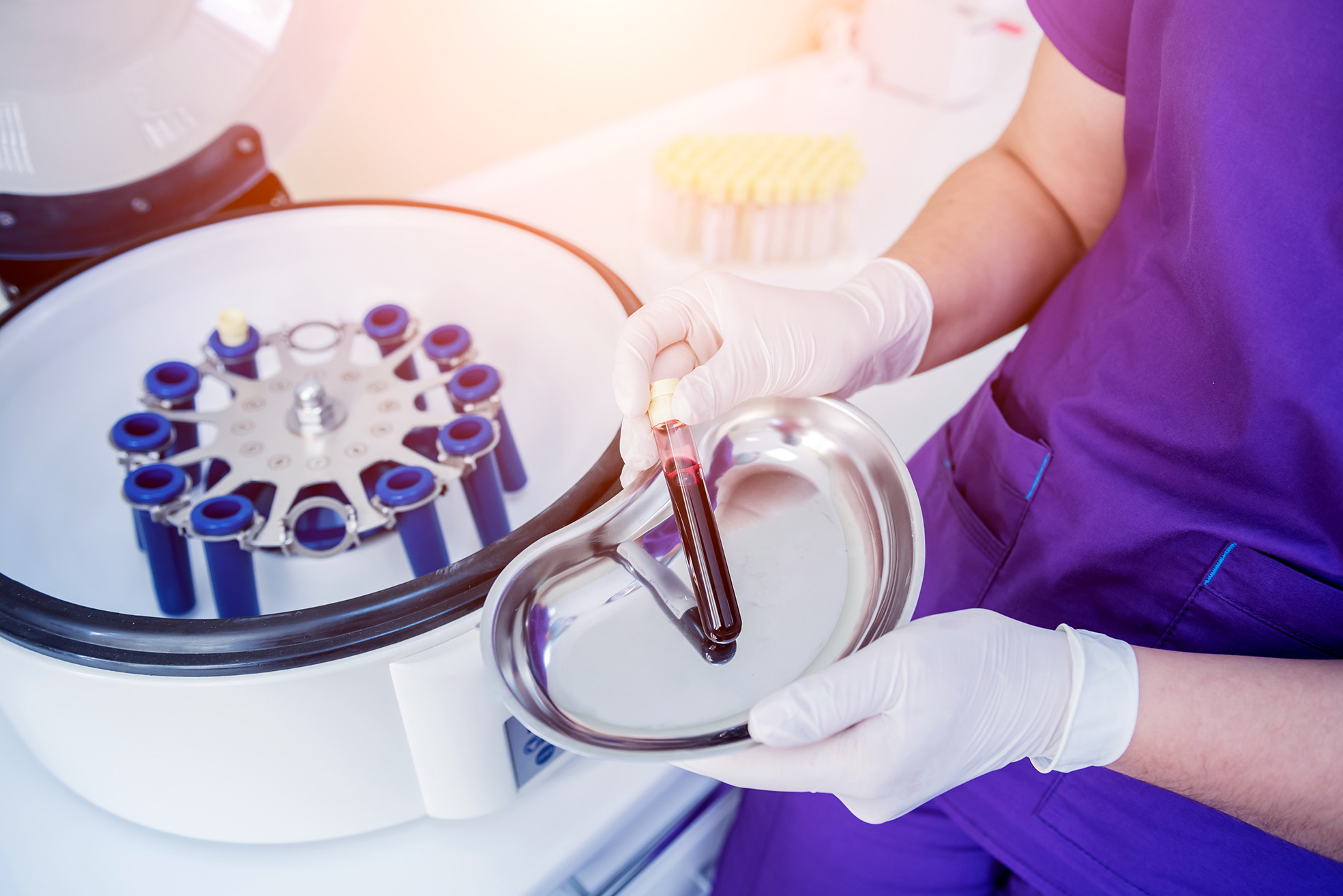 St. Andrews Clinics | Services | PRP Therapy