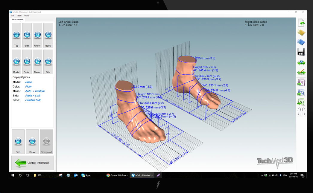 Scanner 3D para ortopedia I Sensor Canvas I Brasil