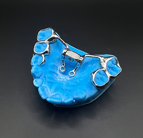 TAD System | Zan Ortho Lab