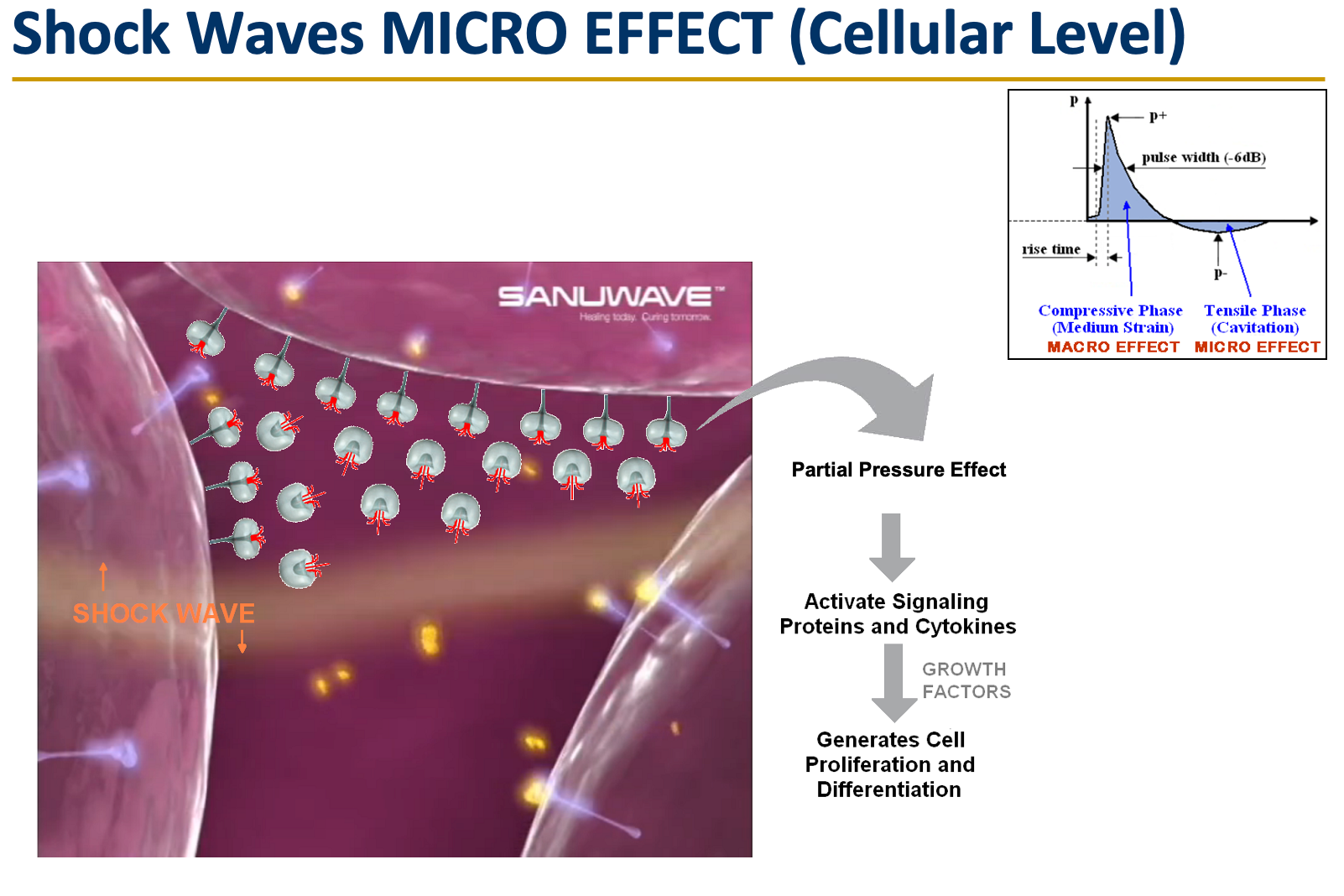 Sanuwave Profile | Acoustek | ESWT Therapy and Shockwave Therapy