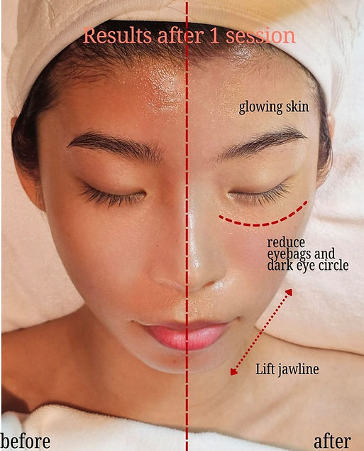 Book Your $68 TCM Bojin Facial Trial | Dr Hannah TCM Spa | Singapore