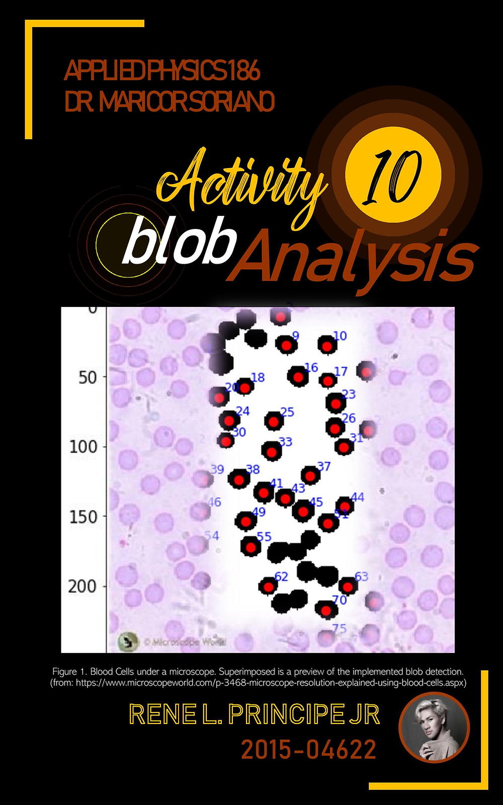 Blob Analysis