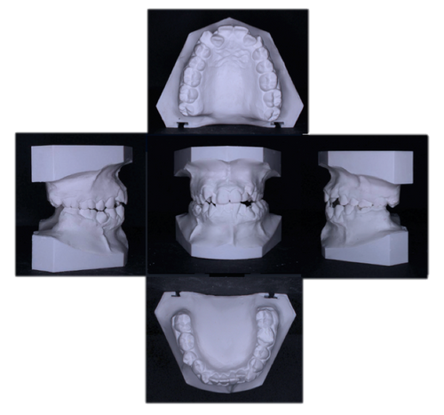 Modelos de Estudio | Digitalium Rx