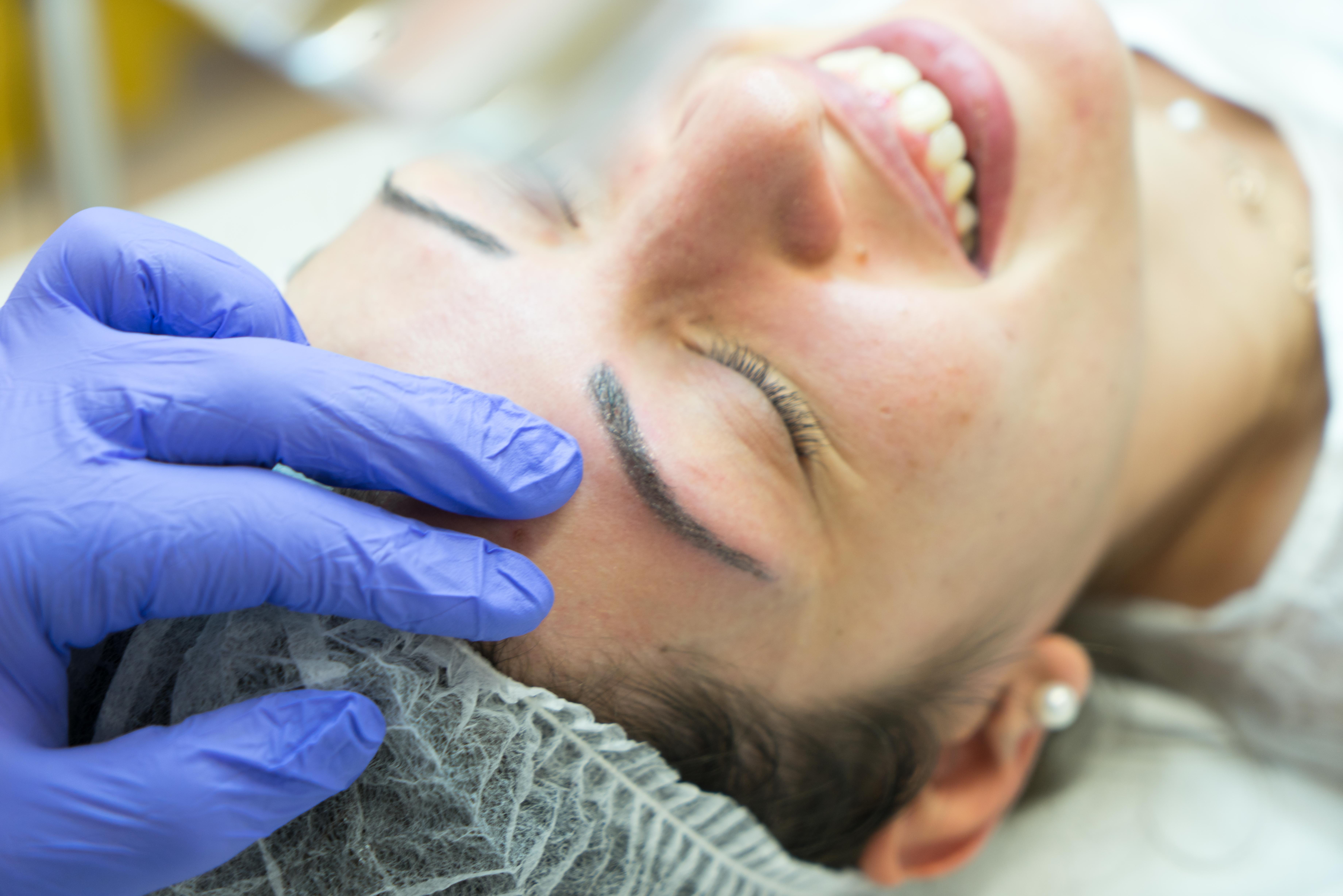 Tattoo removal-Ηλίας Τσιγαρίδας| Dermacraft / Dermagraph