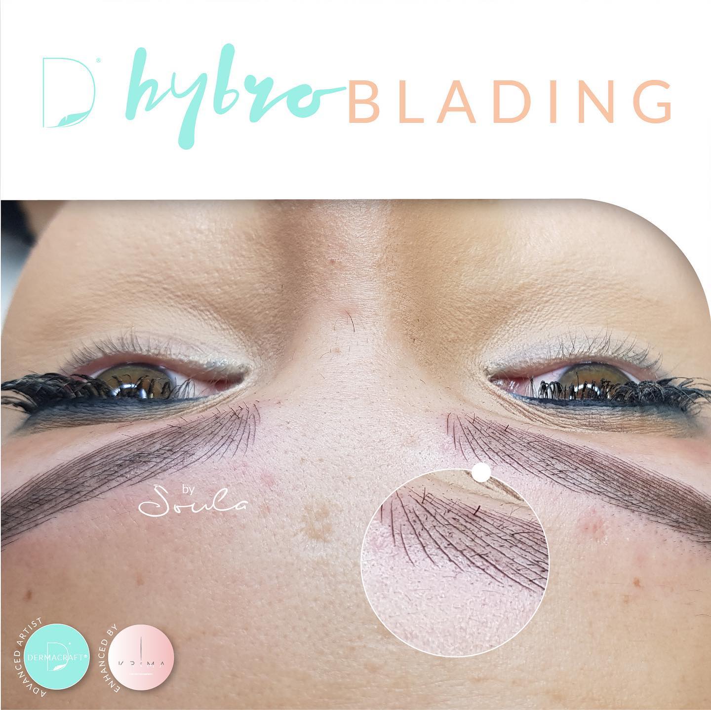 Η ΙΣΤΟΡΙΑ ΜΑΣ | dermagraph-greek