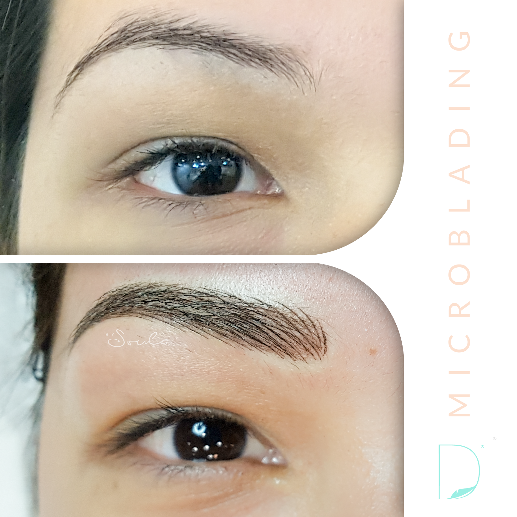 dermagraph-greek | Η ΙΣΤΟΡΙΑ ΜΑΣ