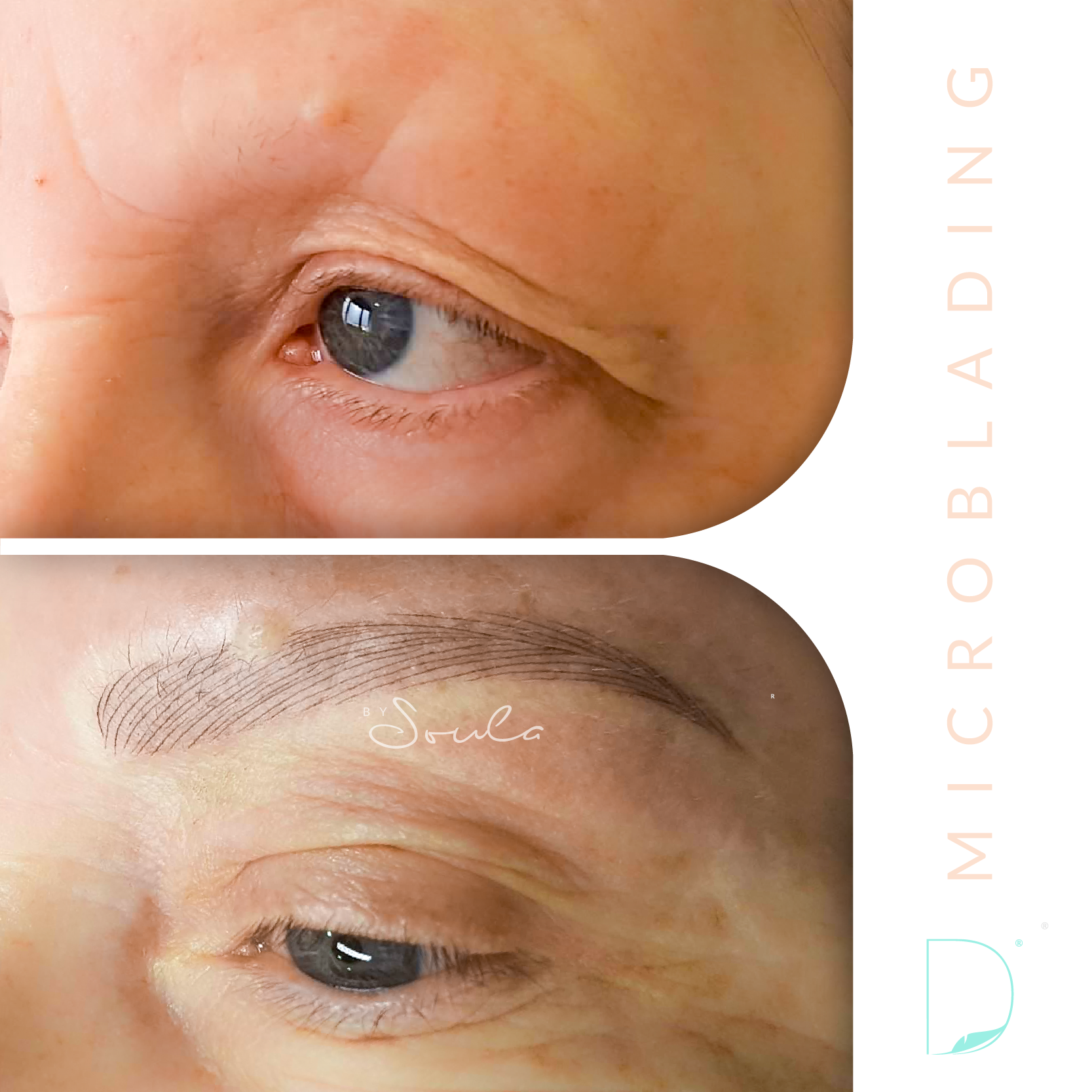 dermagraph-greek | Η ΙΣΤΟΡΙΑ ΜΑΣ