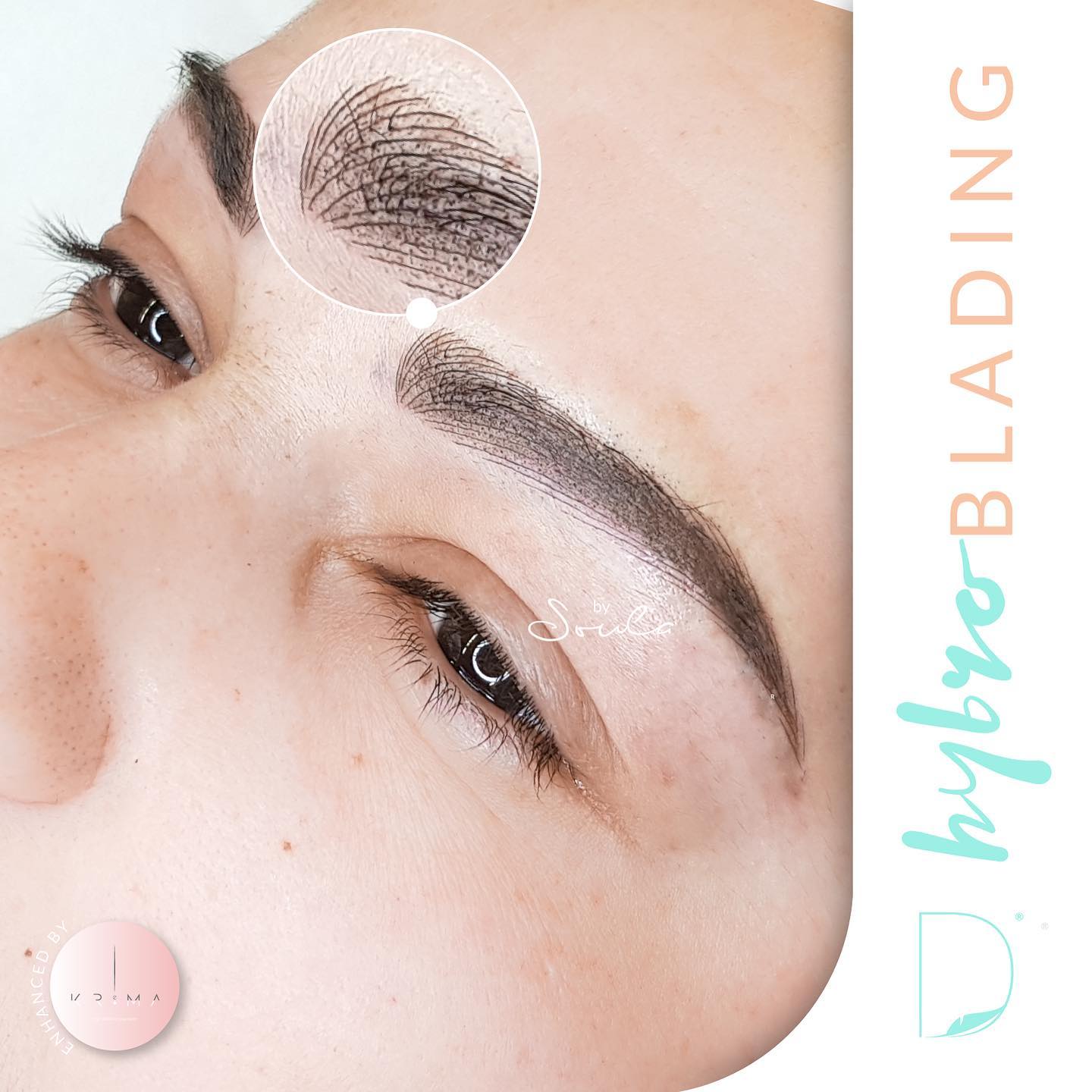 Η ΙΣΤΟΡΙΑ ΜΑΣ | dermagraph-greek