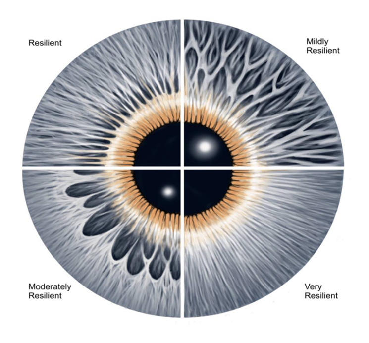 What is Iridology?
