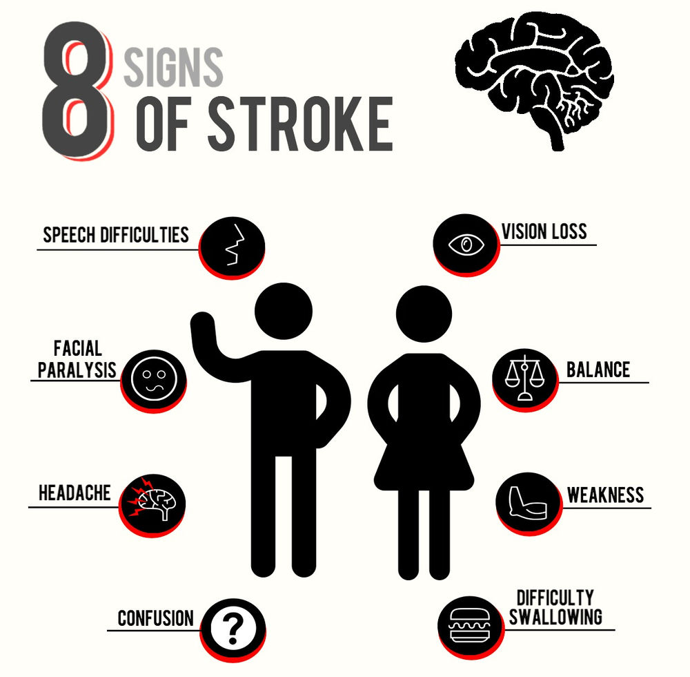Stroke Rehabilitation Stroke Rehabilitation