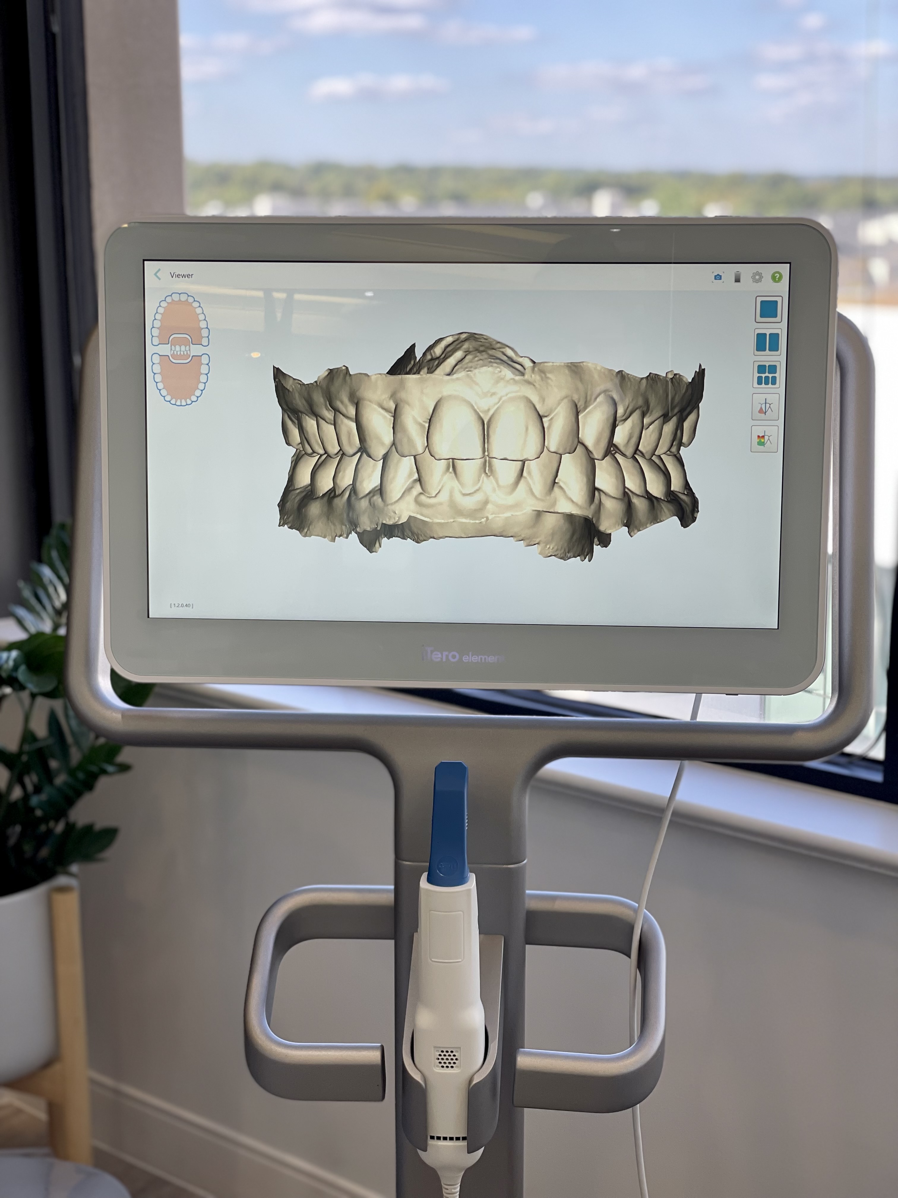 Scanning technology for Invisalign!