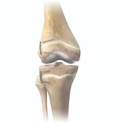 Orthopediatrics | Next Step Medical
