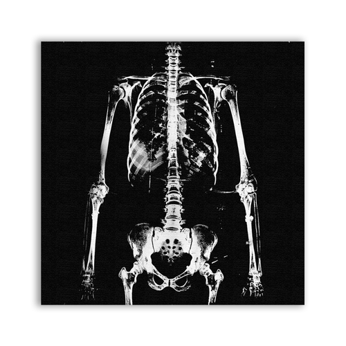 X-ray Body Patch | Cemetery Crypt