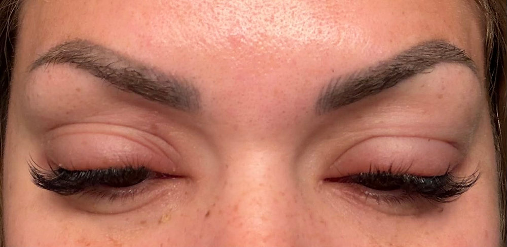 Understanding Allergic Reactions to Lash Extensions: Symptoms, Causes ...