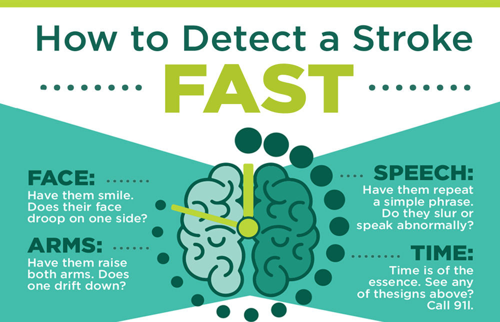 How can we detect a stroke?