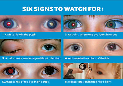 Kids Eye Cancer | Retinoblastoma Queensland