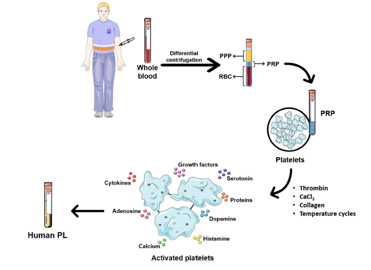 Plasma Rico em Plaquetas (PRP) Bioink