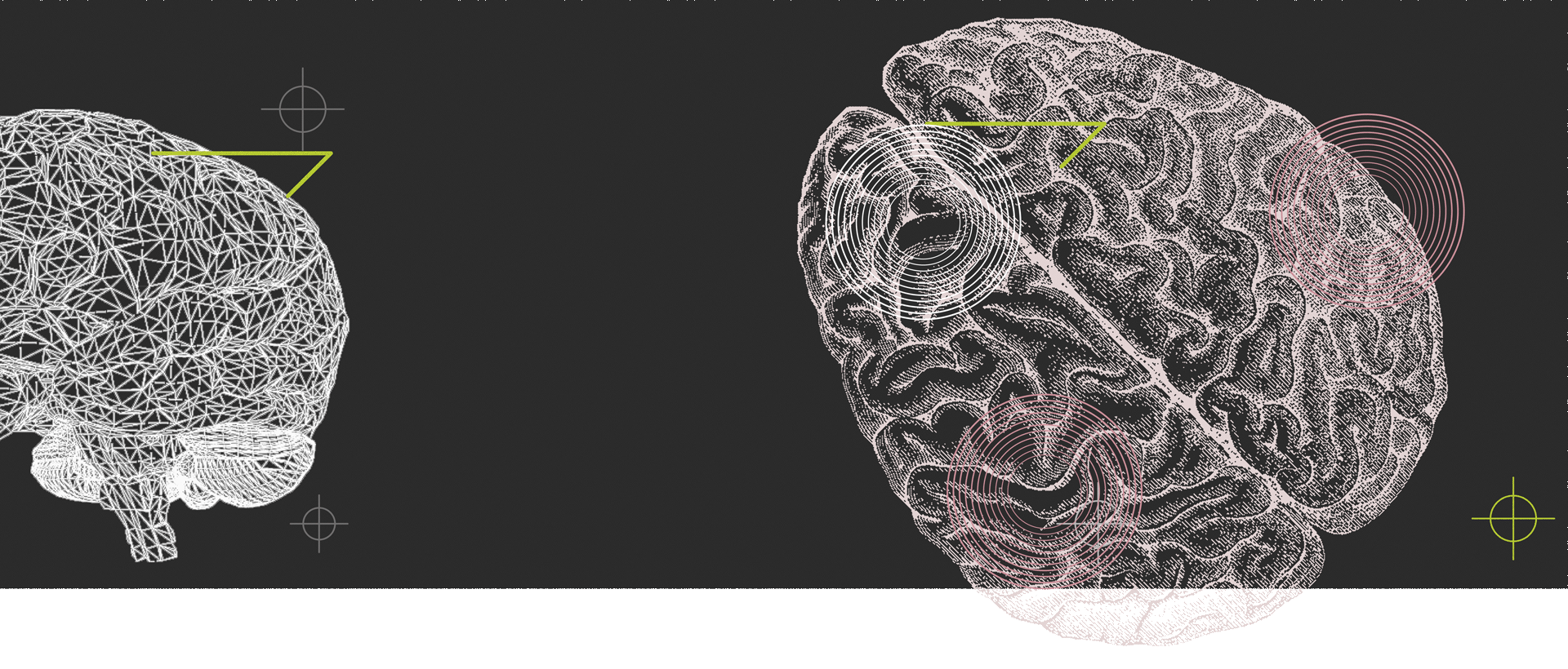 EEG Biomarkers for Neurodegeneration | Starlab
