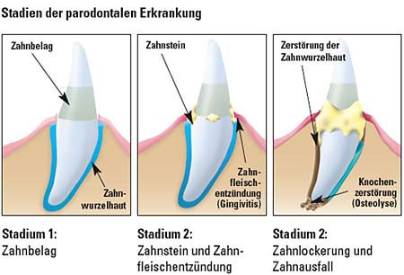 Zahnstein entfernung | hundeschulebully