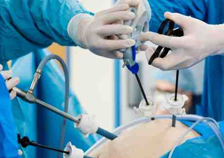 General and Minimal Access Surgery