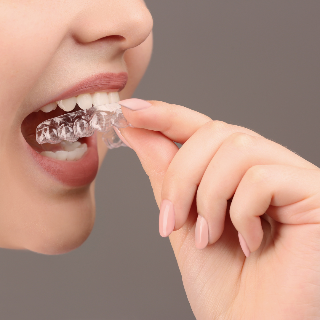 Guarda Oclusal | Dentaler