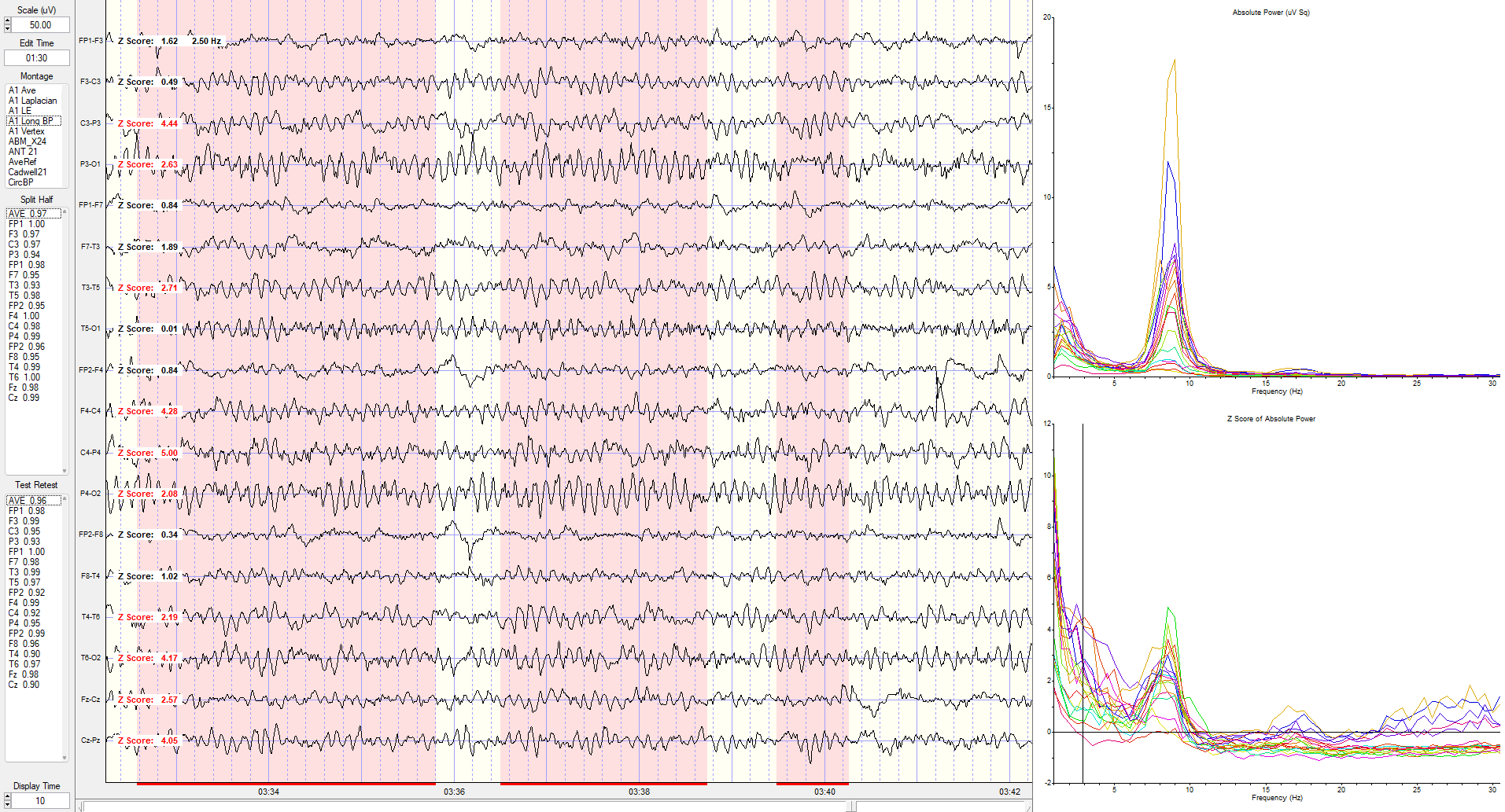 A Guide to Interpreting EEG Topographic Maps