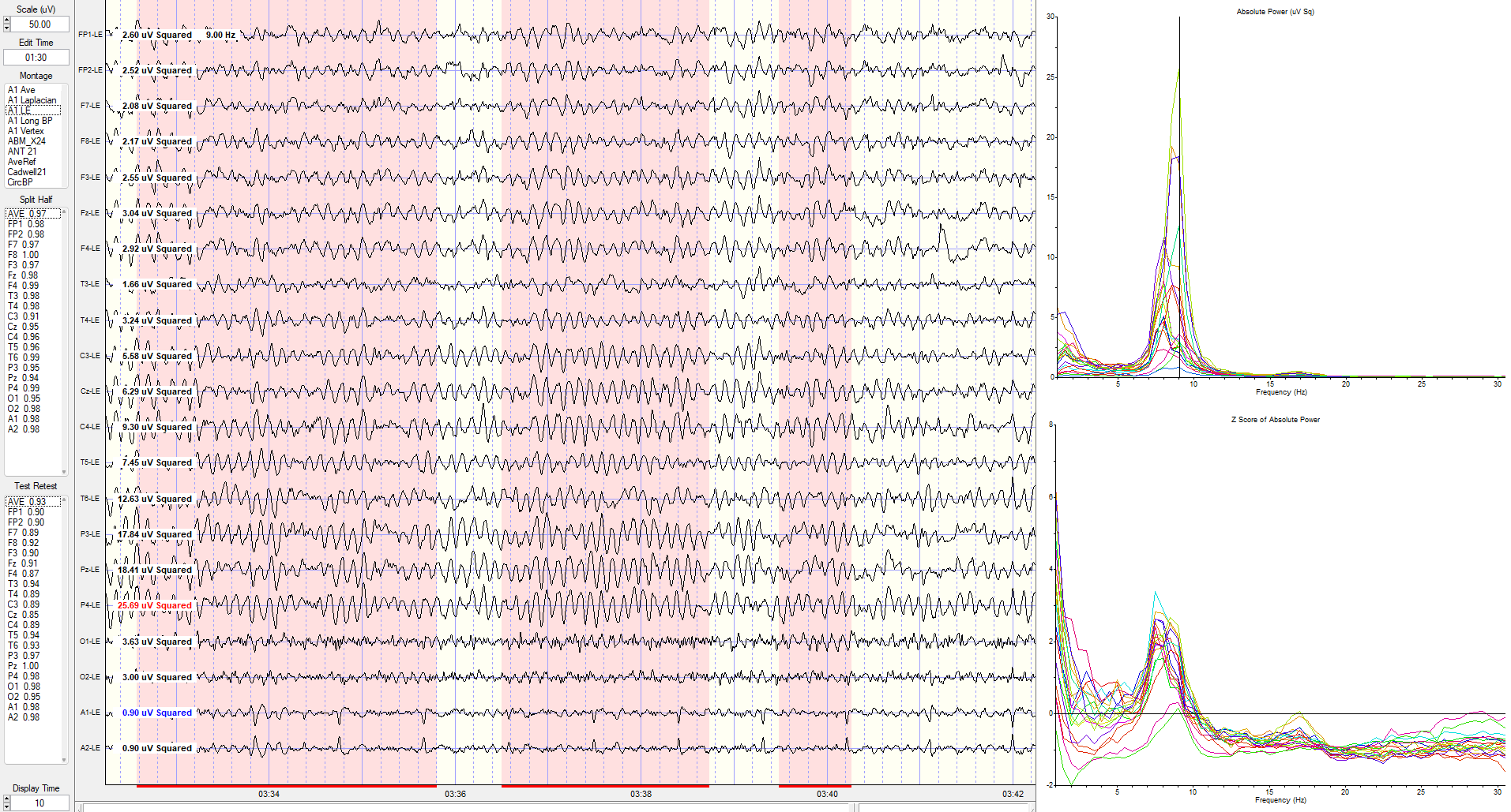 A Guide to Interpreting EEG Topographic Maps