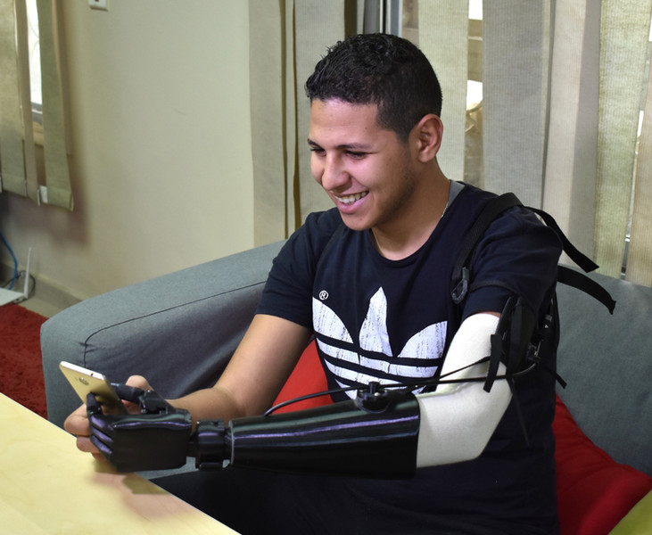 3D Printed Hand | Victoria Hand Project