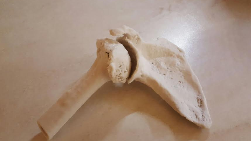 La stampa 3D di parti anatomiche spiegata in 4 semplici passaggi.