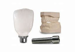 E-MAX SCREW RETAINER CROWN/T-BASE | Coral Gables Dental